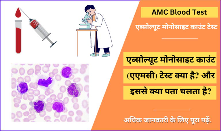 एब्सोल्यूट मोनोसाइट काउंट (एएमसी) टेस्ट - AMC Blood Test in Hindi