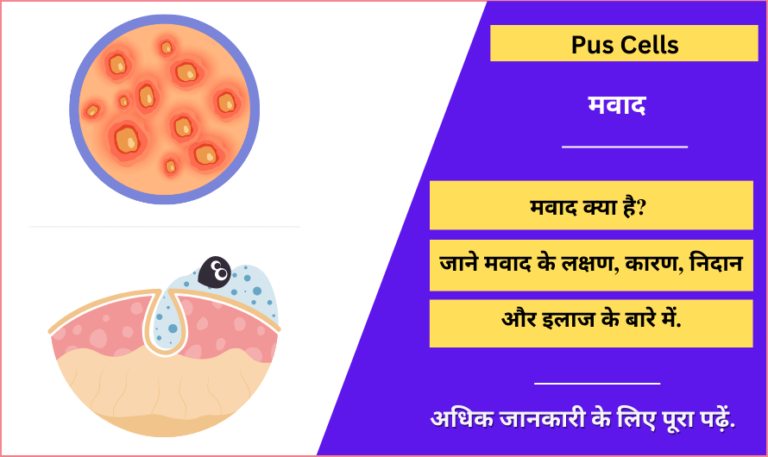 मवाद - Pus Cells in Hindi, Symptoms, Causes, Treatment
