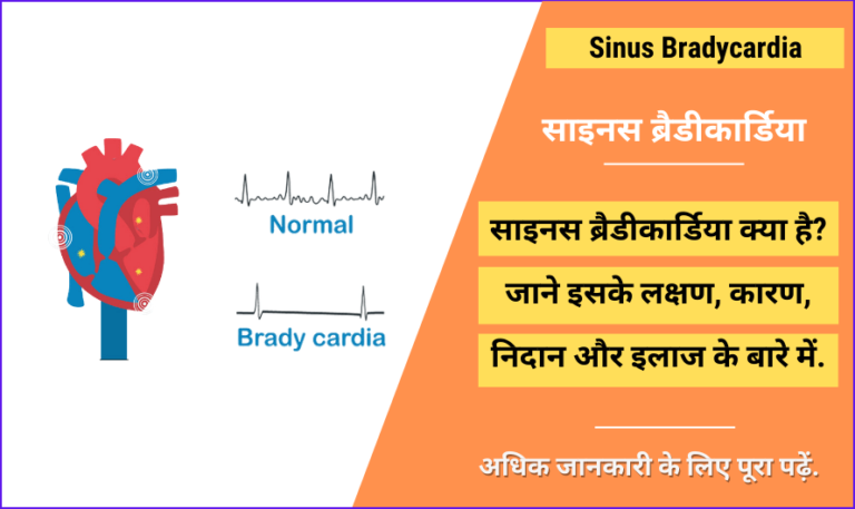 साइनस ब्रैडीकार्डिया - Sinus Bradycardia in Hindi, Symptoms, Causes
