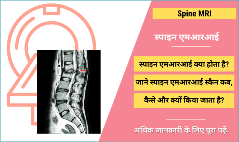 प्रोलैक्टिन टेस्ट - Prolactin Test in Hindi, Test price, Normal Range प्रोलैक्टिन टेस्ट - Prolactin Test in Hindi, Test price, Normal Range